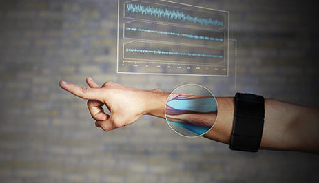 Muscle activity-based gesture control device allows users to wirelessly ...